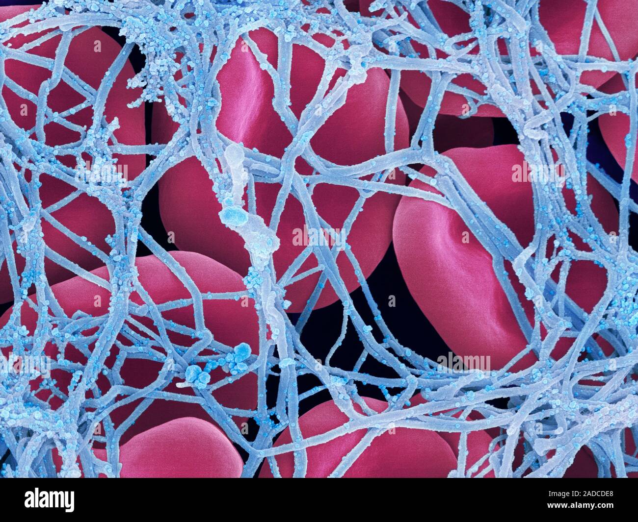 Coloured scanning electron micrograph of human red blood cells trapped ...