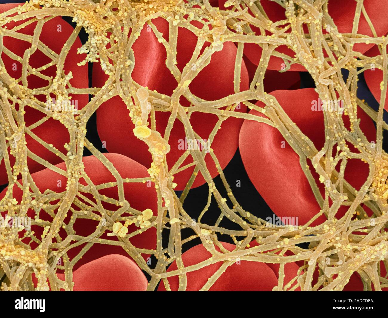 Coloured scanning electron micrograph of human red blood cells trapped ...
