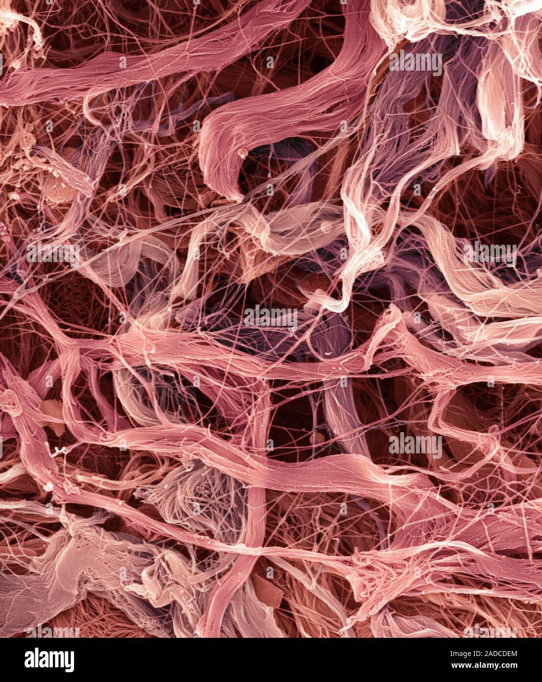 Coloured scanning electron micrograph (SEM) of collagen bundles in a ...