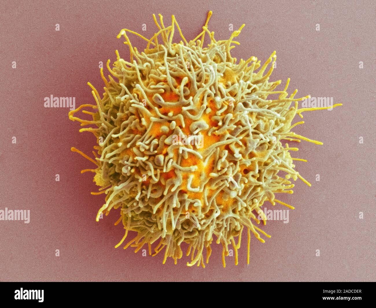 Coloured scanning electron micrograph (SEM) of a megakaryocyte ...