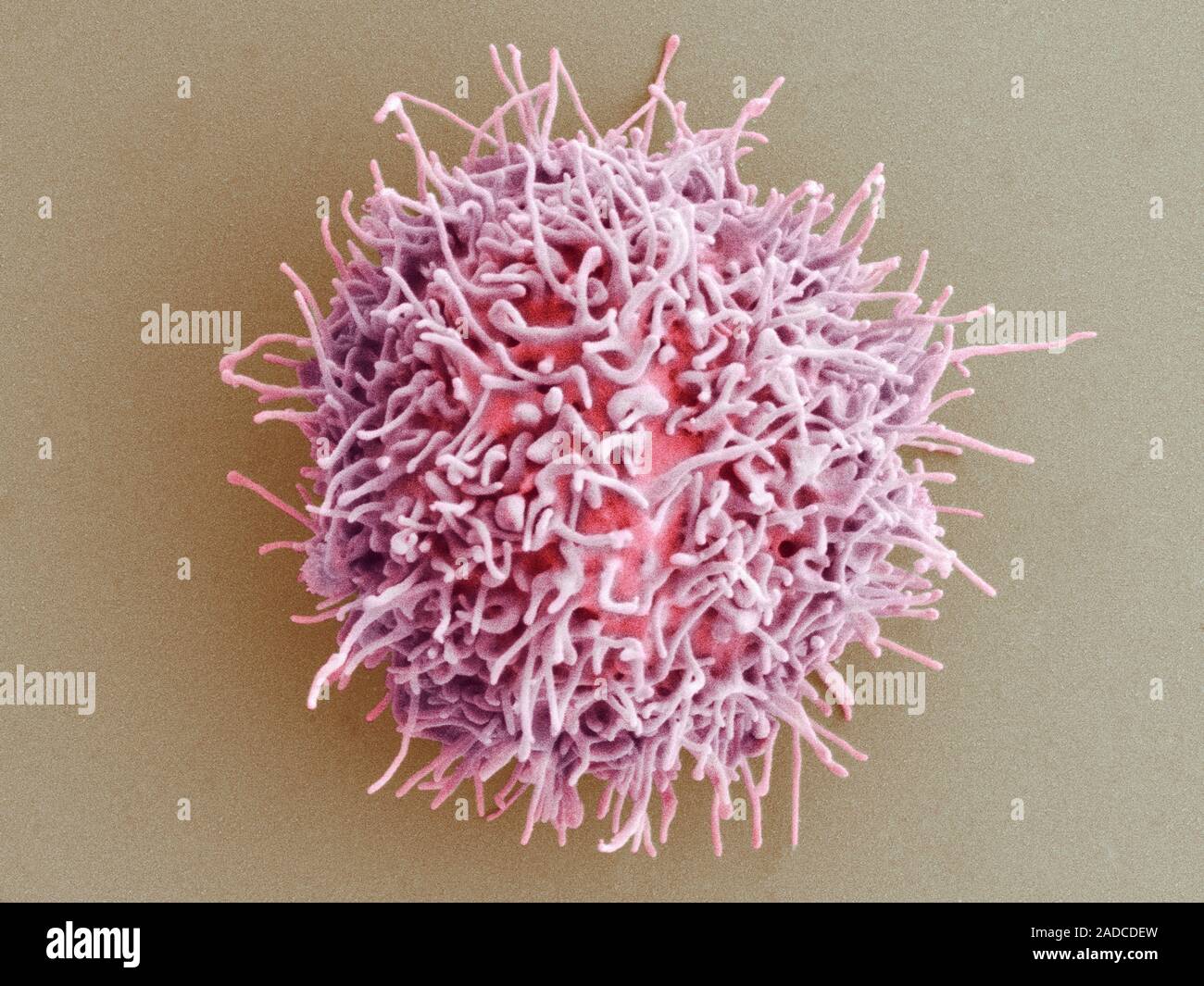 Coloured scanning electron micrograph (SEM) of a megakaryocyte ...