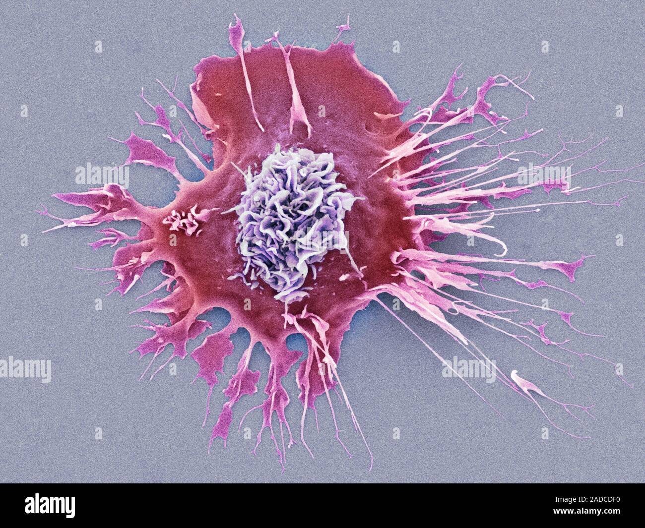 Human dendritic cell, coloured scanning electron micrograph (SEM ...