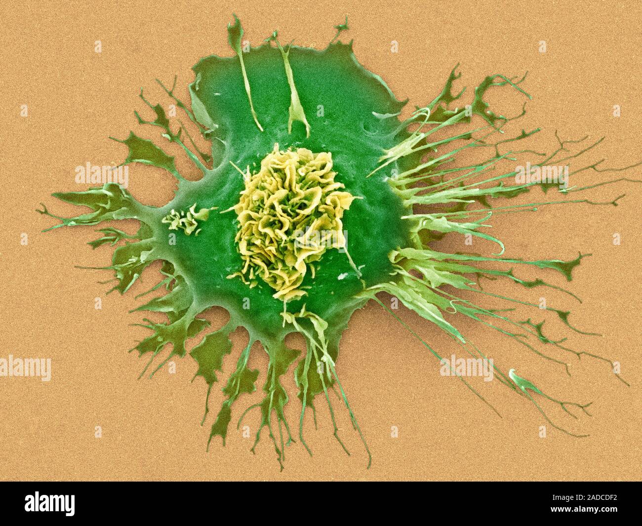Human dendritic cell, coloured scanning electron micrograph (SEM ...