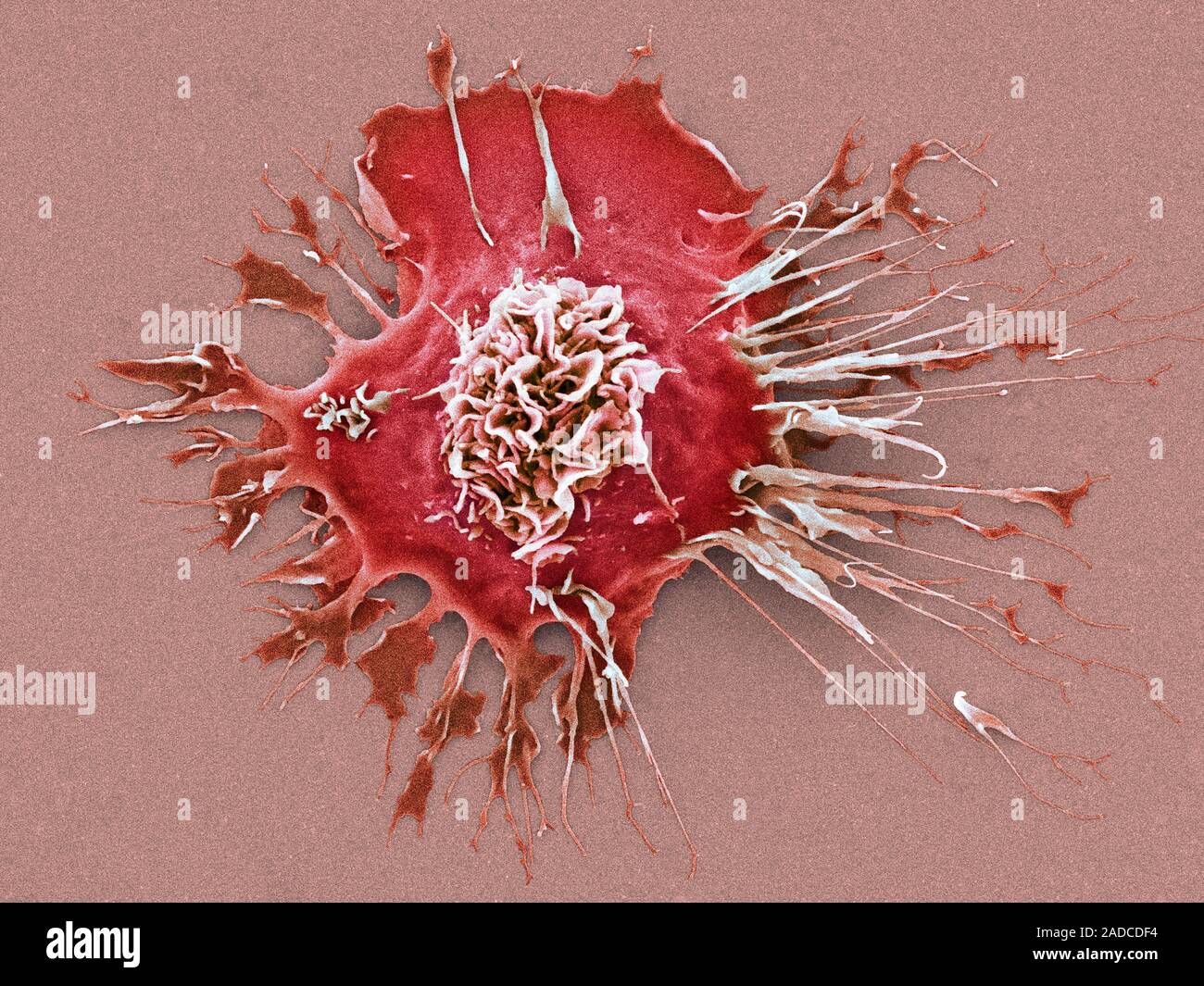 Human dendritic cell, coloured scanning electron micrograph (SEM ...