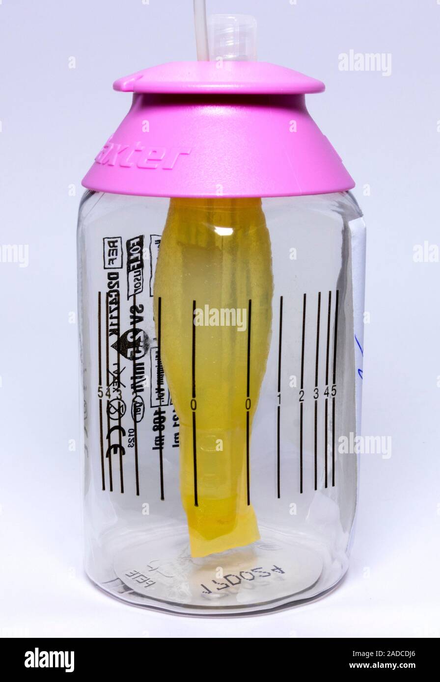 Elastomeric pumps, also called balloon pumps, are usually used in the ...