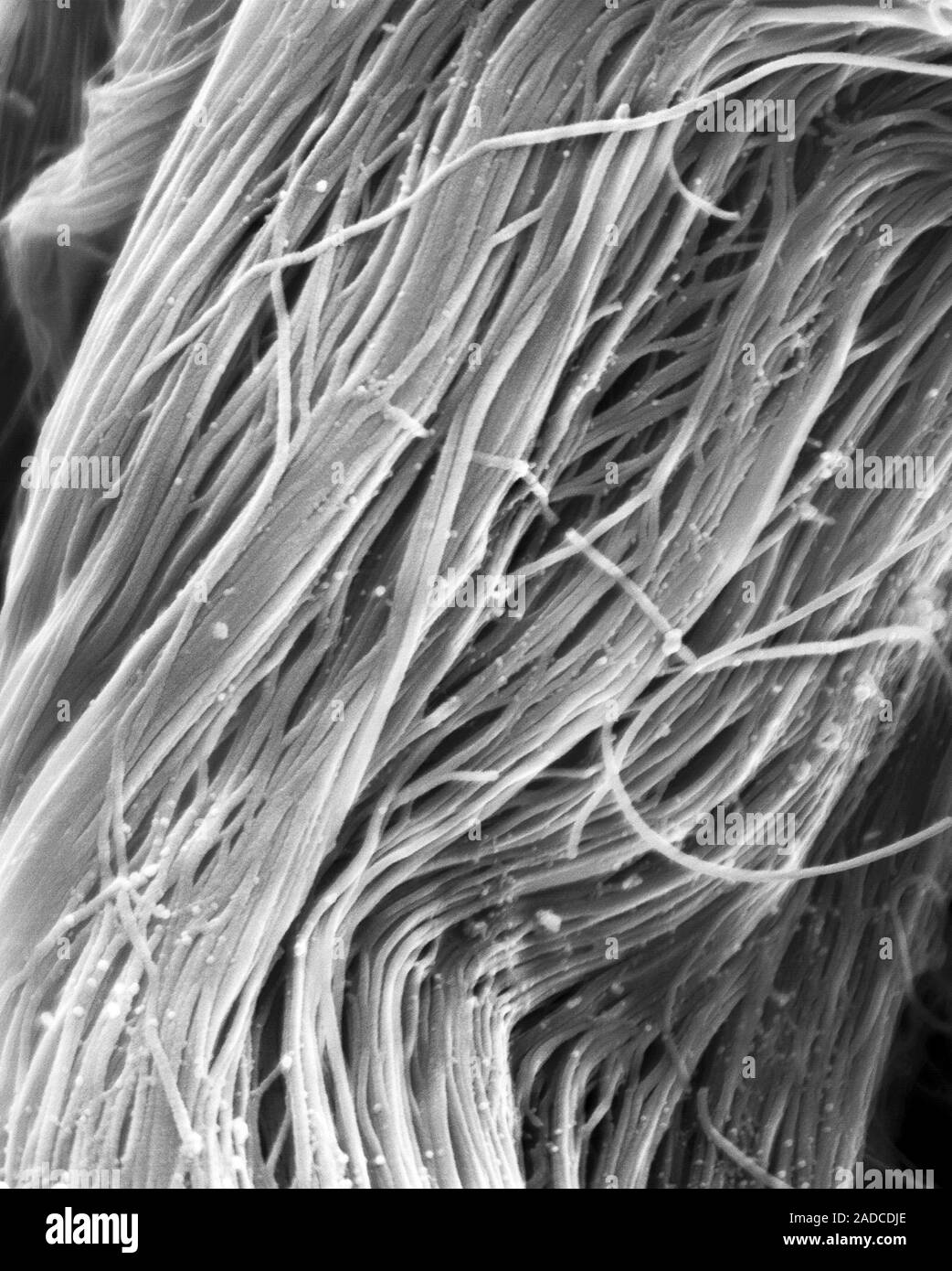 Collagen fibre bundle (connective tissue) in human heart muscle ...