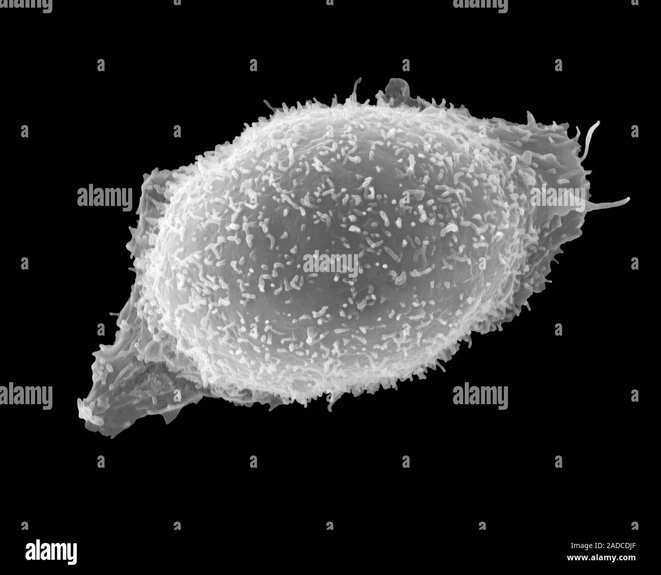 Mast cell, scanning electron micrograph (SEM). A type of immune cell in ...