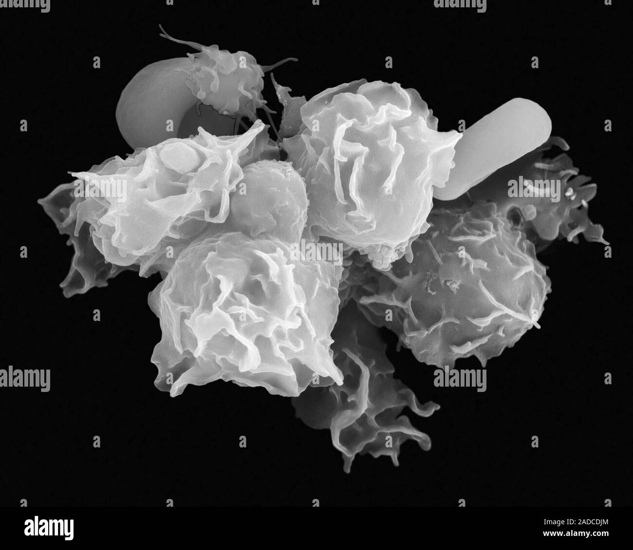 Granulocytic white blood cells (neutrophils), red blood cells and ...