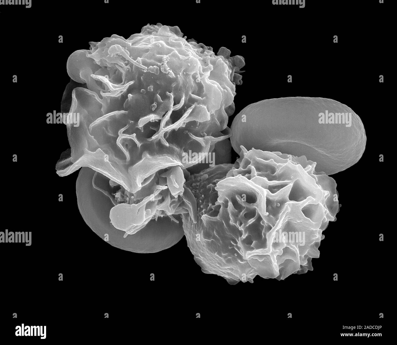 Granulocytic white blood cells (neutrophils) and red blood cells ...