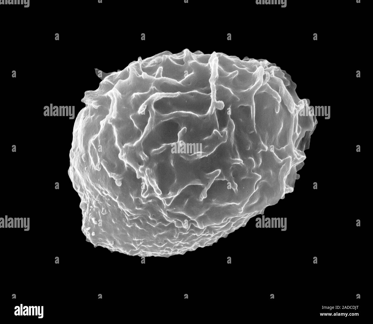 Granulocytic white blood cell, scanning electron micrograph (SEM ...