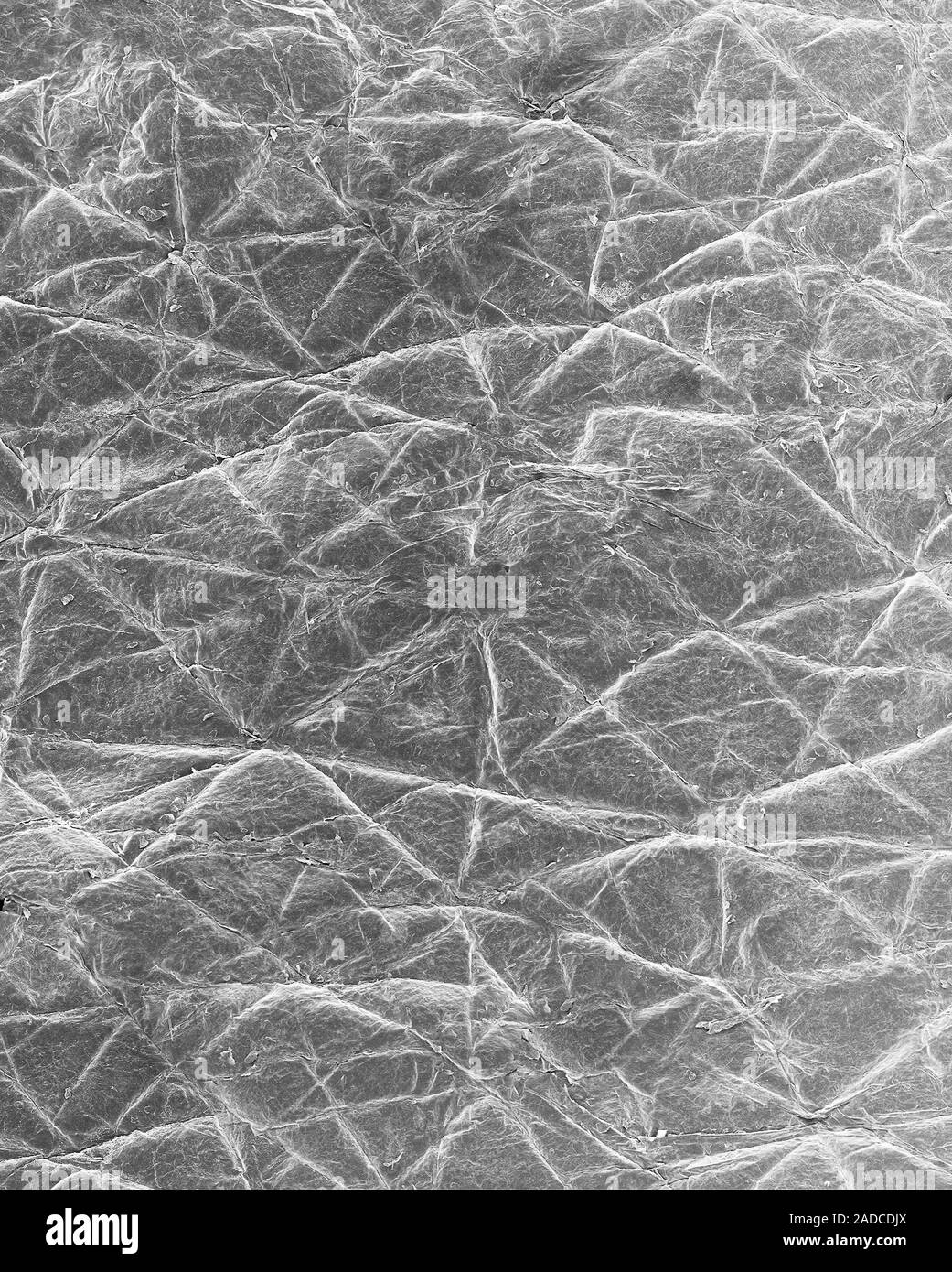 Human skin (epidermis), scanning electron micrograph (SEM). Outer ...