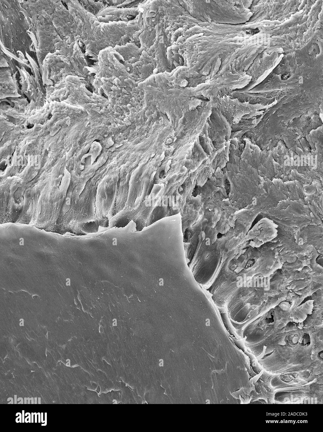 Bone cells (osteocytes) in bone lacunae from a fractured compact bone ...