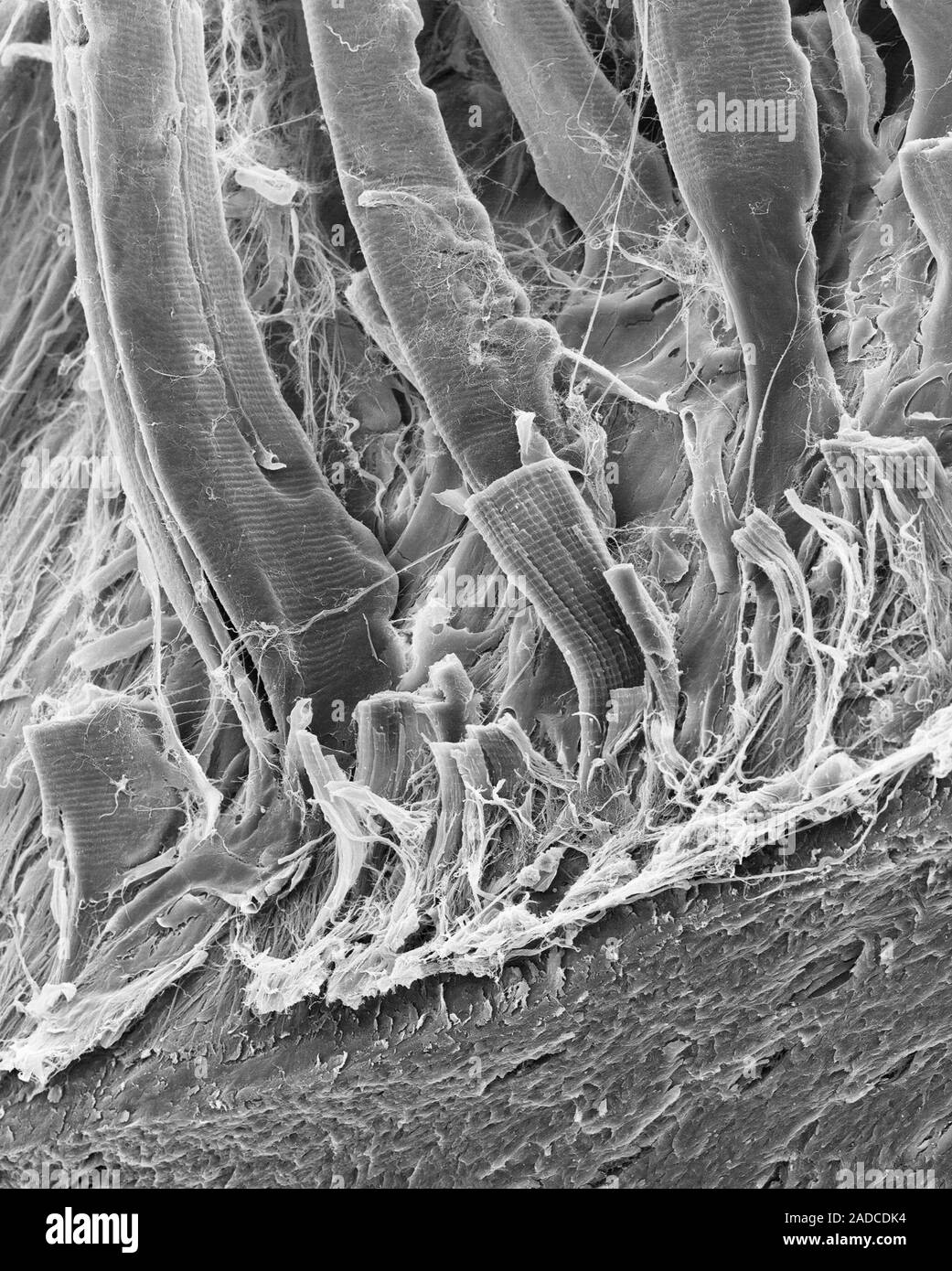 Tendons and other connective tissue attached to a bone surface ...