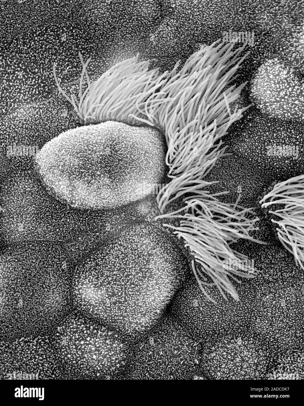 Tracheal epithelium surface, scanning electron micrograph (SEM). The ...