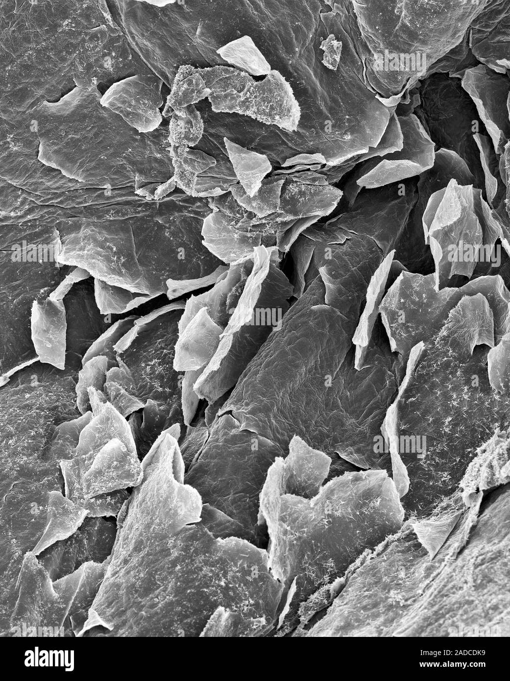 Human skin (epidermis), scanning electron micrograph (SEM). Outer ...