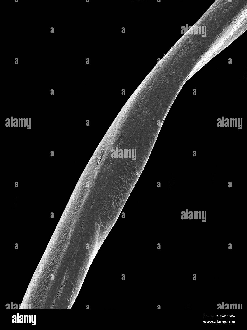 Human pubic hair, scanning electron micrograph (SEM). Notice the ...