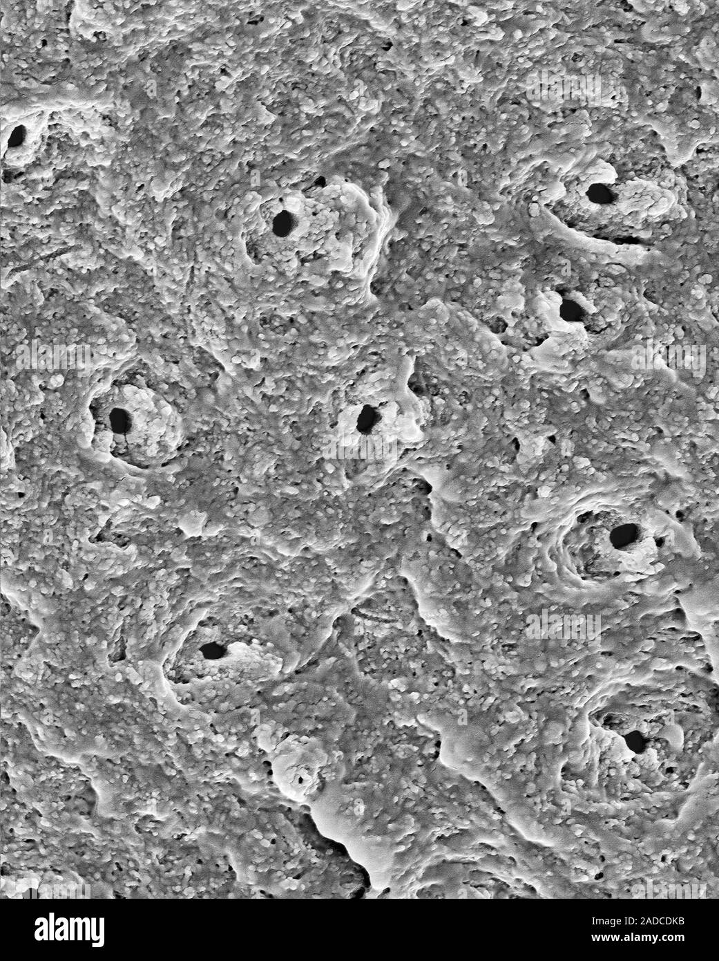 Dentin region of a human tooth with canals or dentinal tubules (dental ...