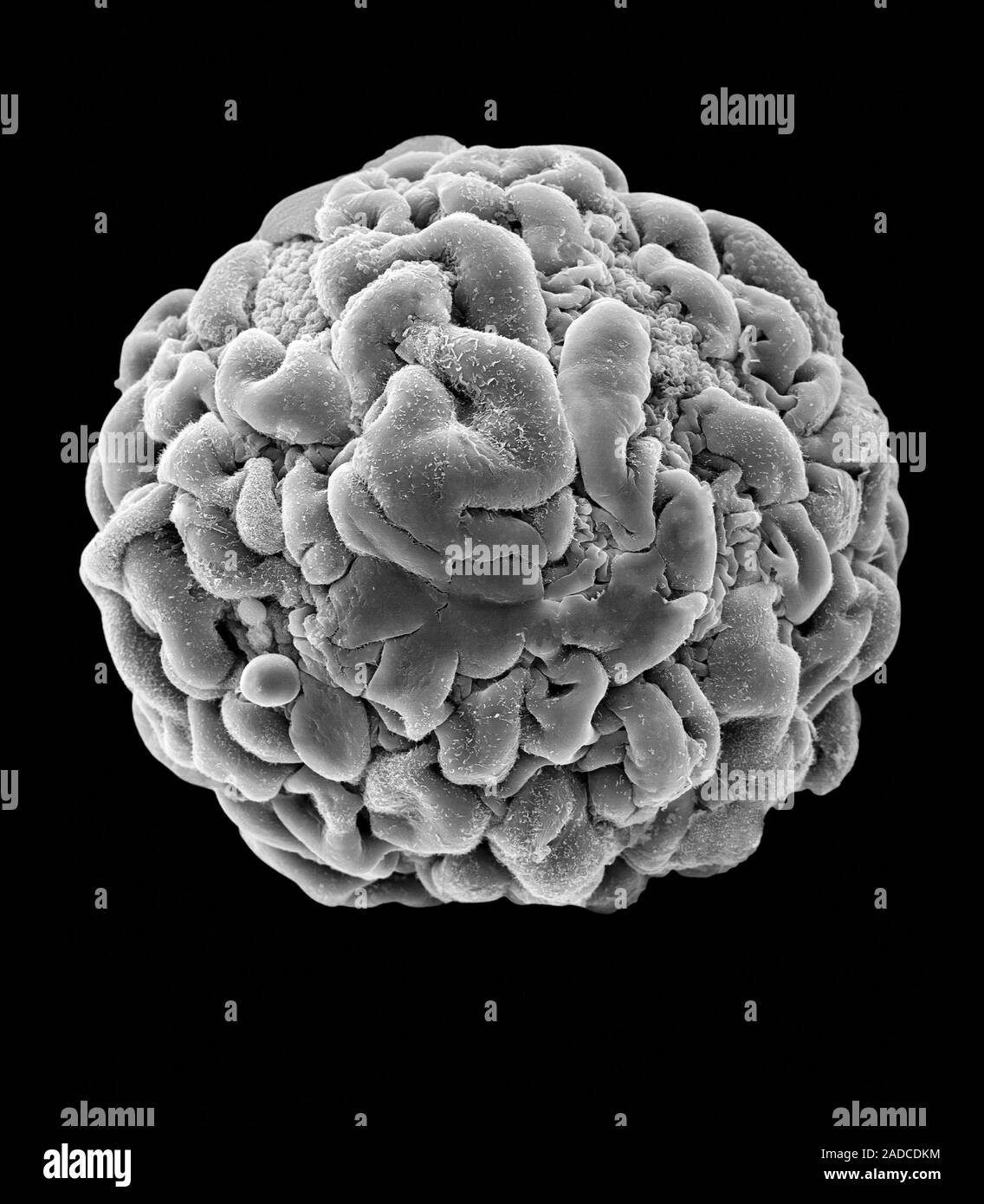 Muscle myoblast sphere grown from a single muscle (myoblast) stem cell ...