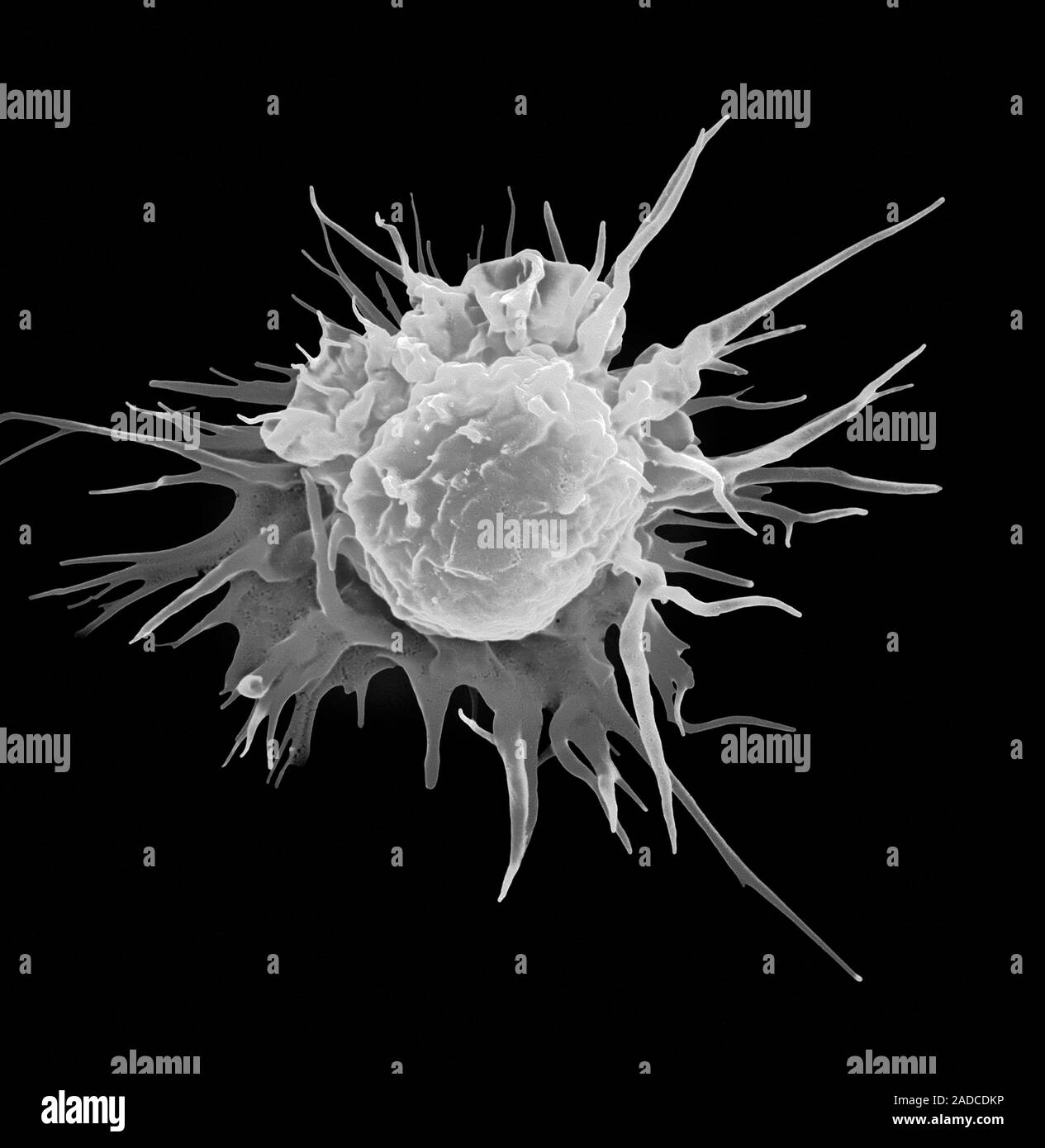 Alveolar tissue macrophage with short filopodia, scanning electron ...