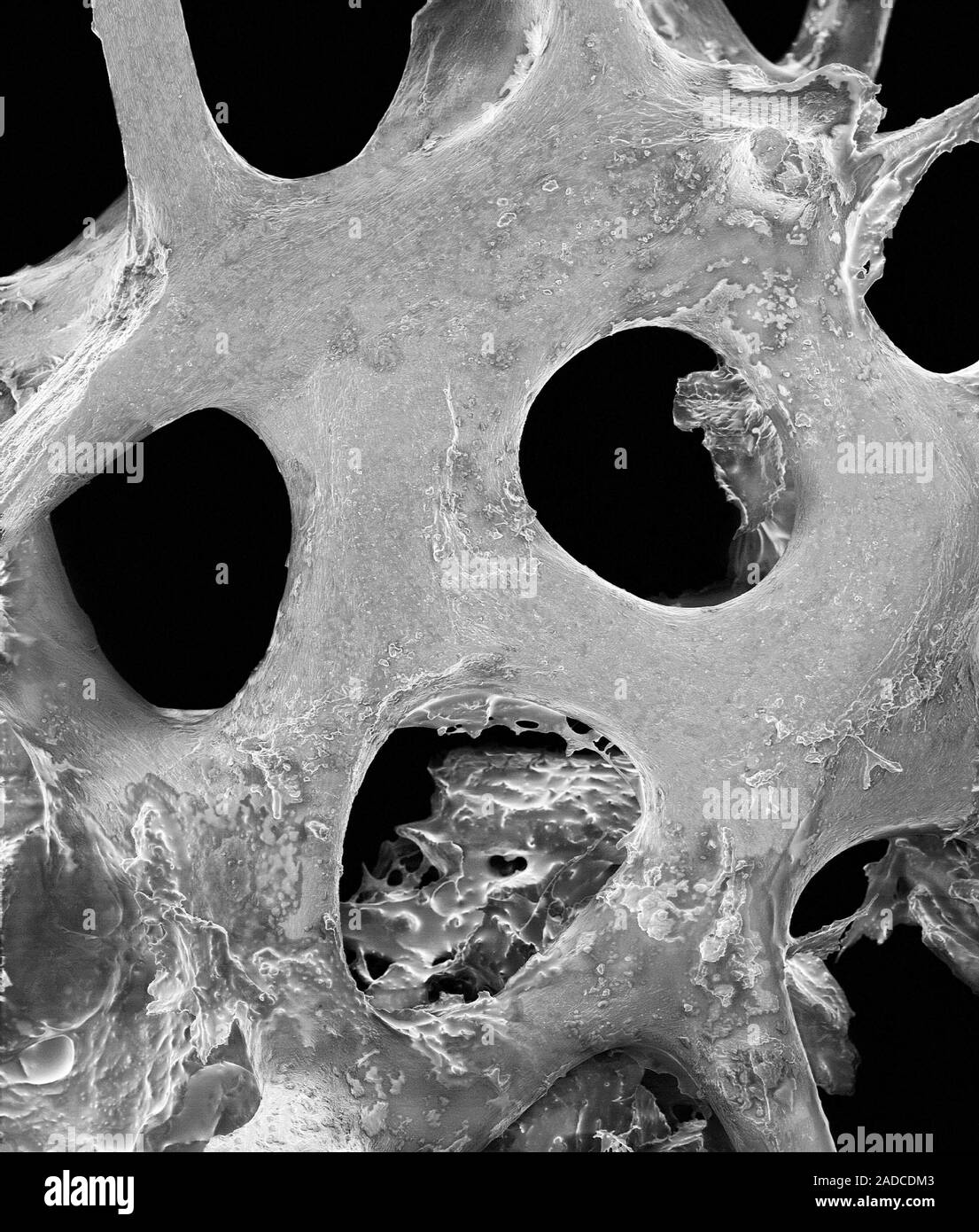 Cancellous (spongy) bone tissue, scanning electron micrograph (SEM ...