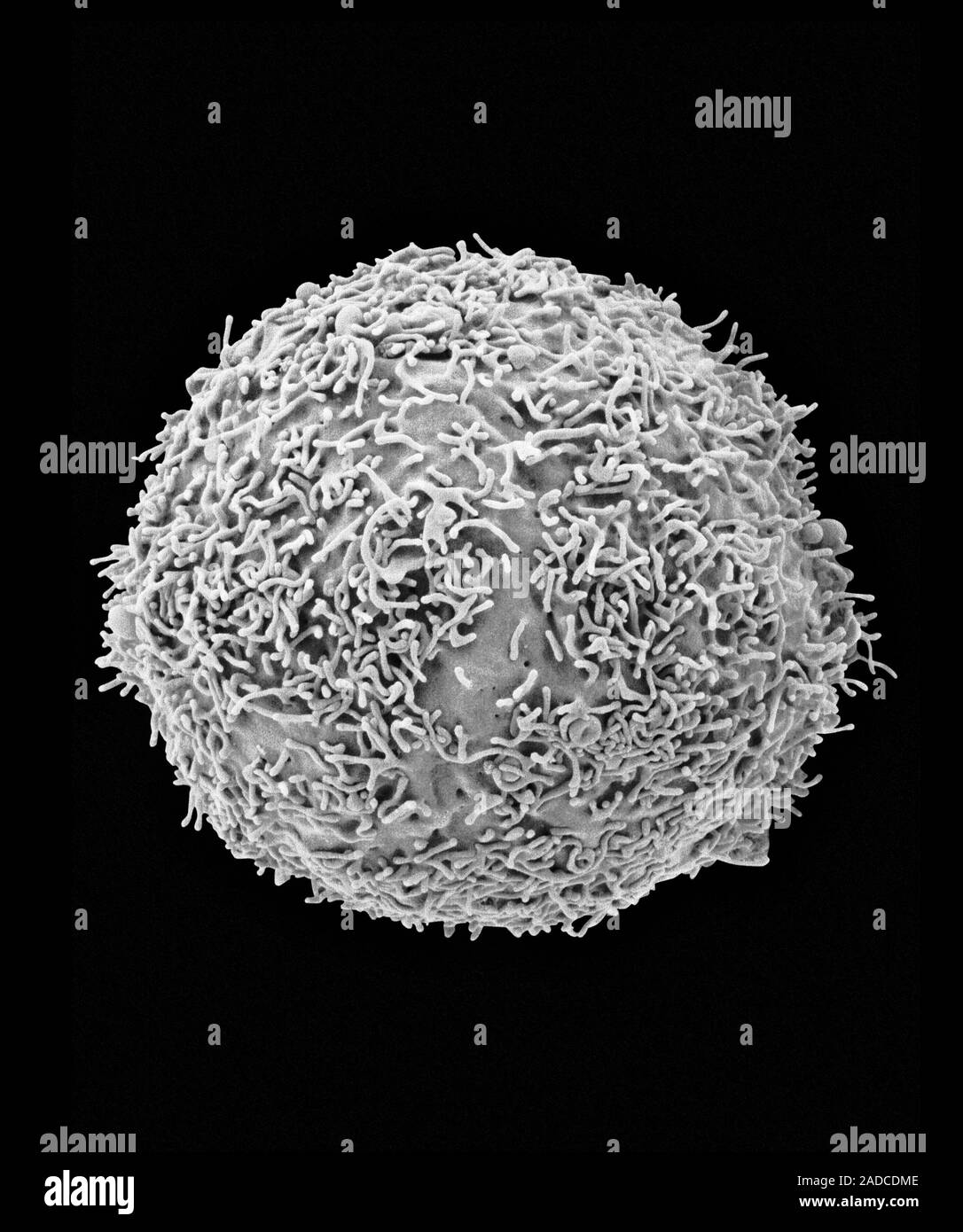Human lymphoblast (Molt-4 cell line) from human bone marrow, scanning ...