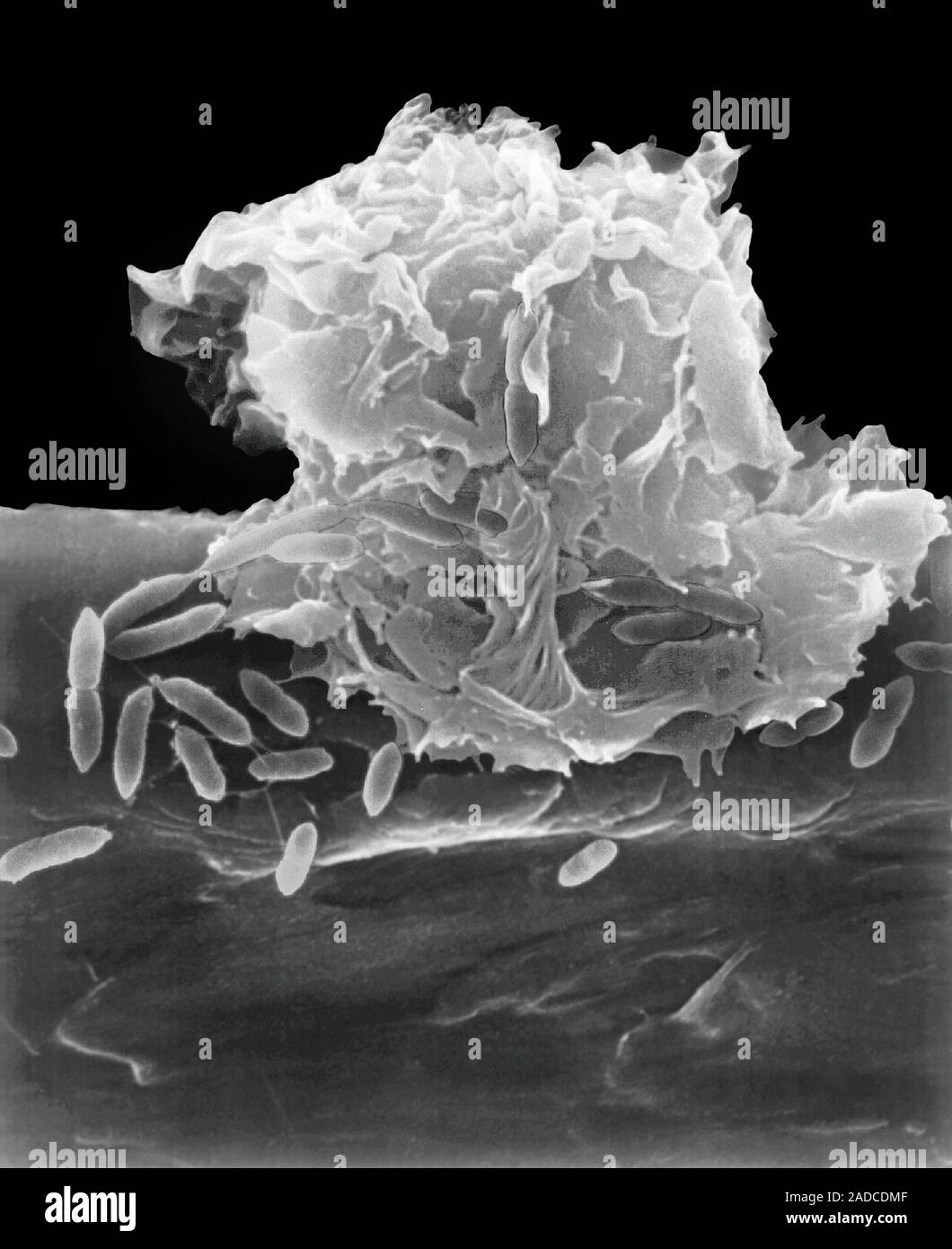 Alveolar macrophage phagocytosis of E. coli on the outer surface of a ...