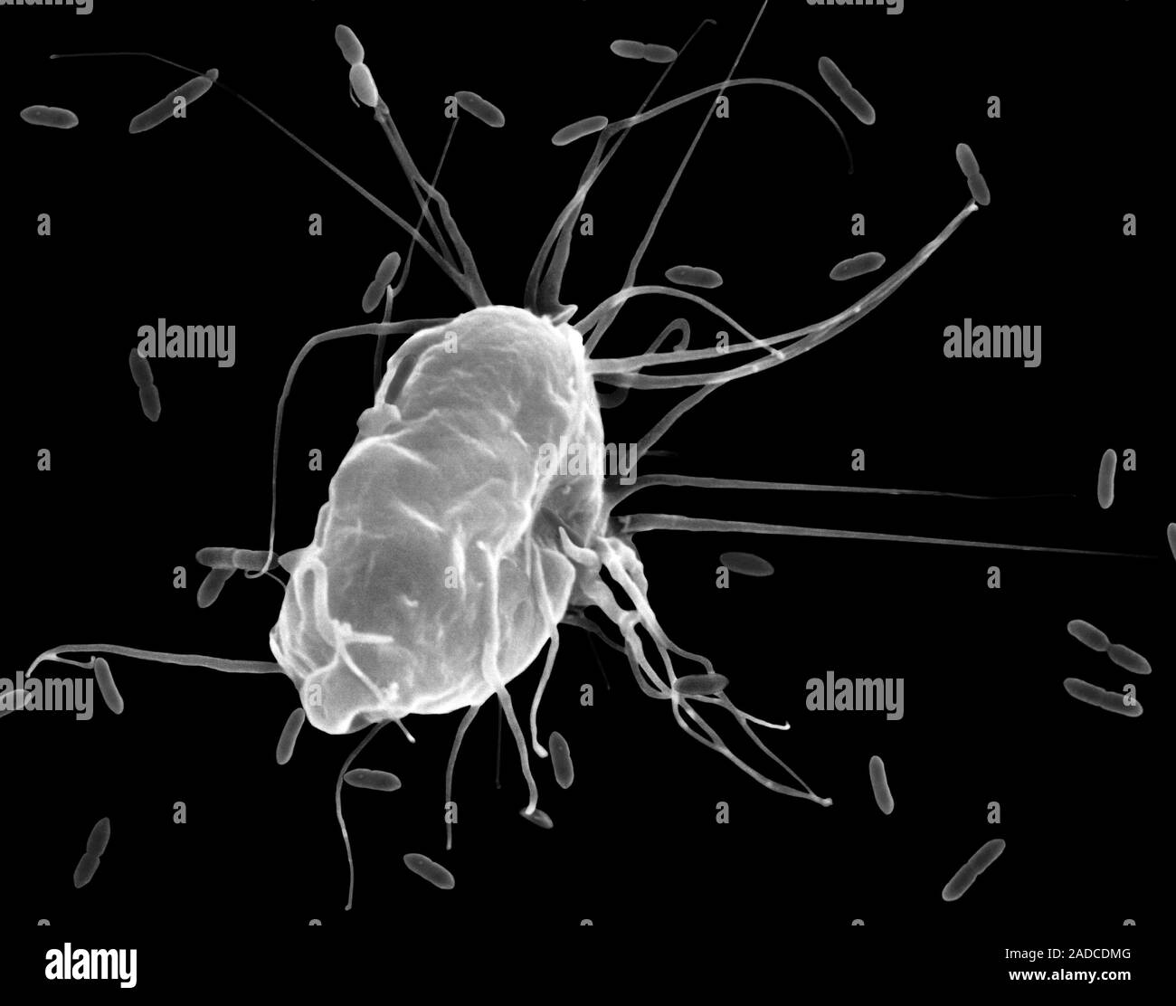 Alveolar macrophage phagocytosis of E. coli (mammal lung pleural cavity ...