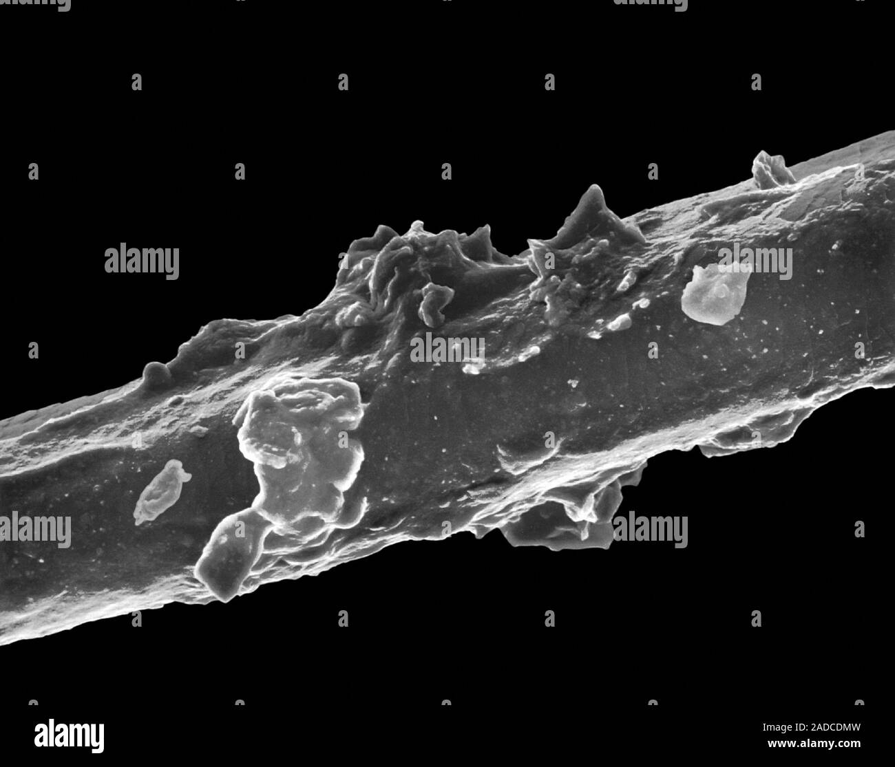 Human eyelash with mascara, scanning electron micrograph (SEM). The ...