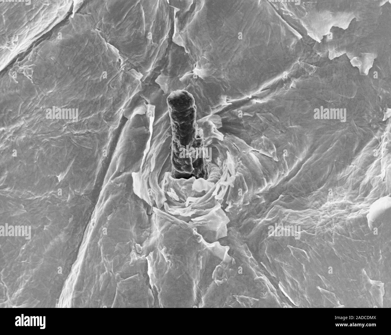 Human skin (epidermis) with hair emerging from a follicle, scanning ...
