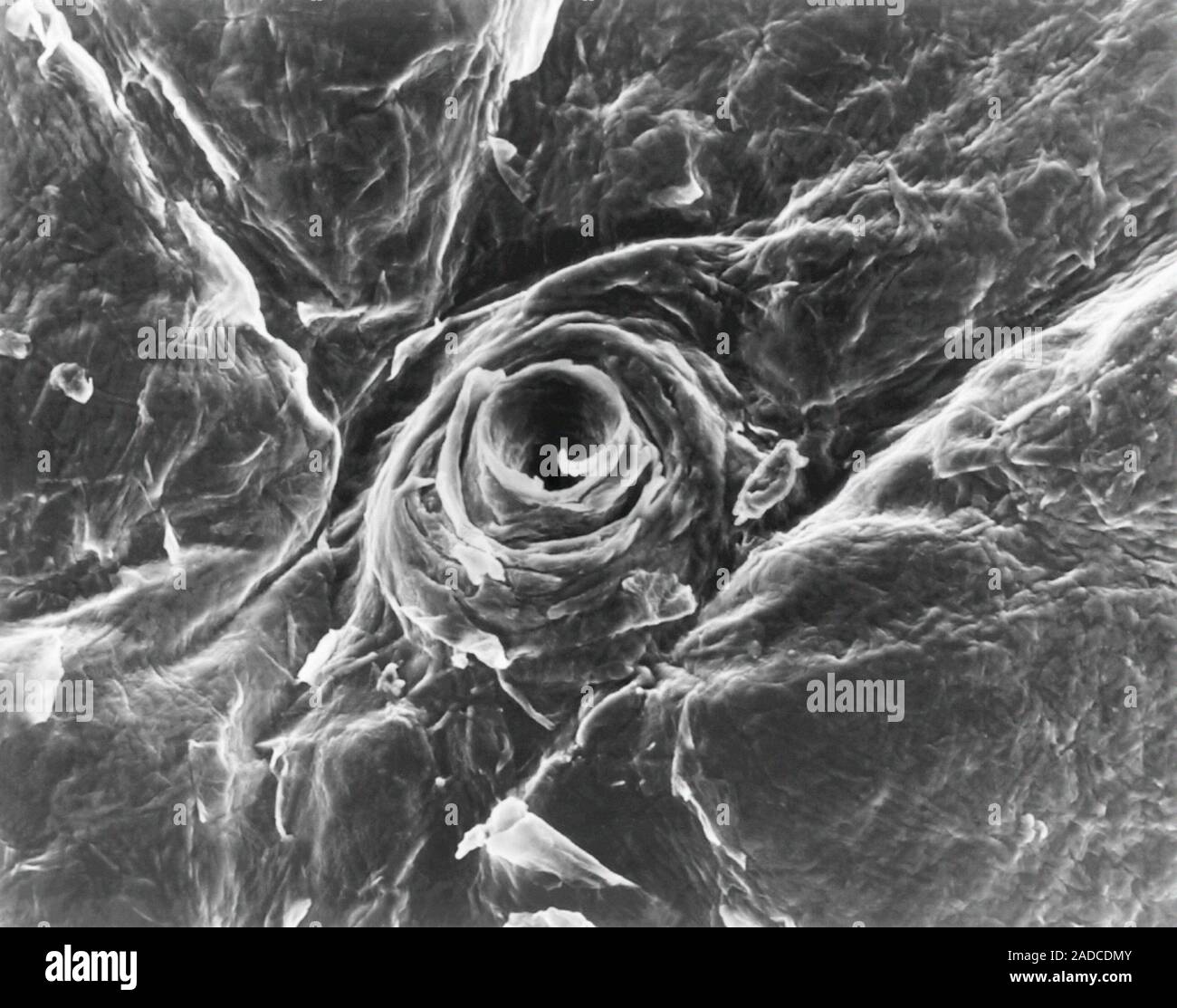 Human skin (epidermis) showing an empty hair follicle, scanning ...