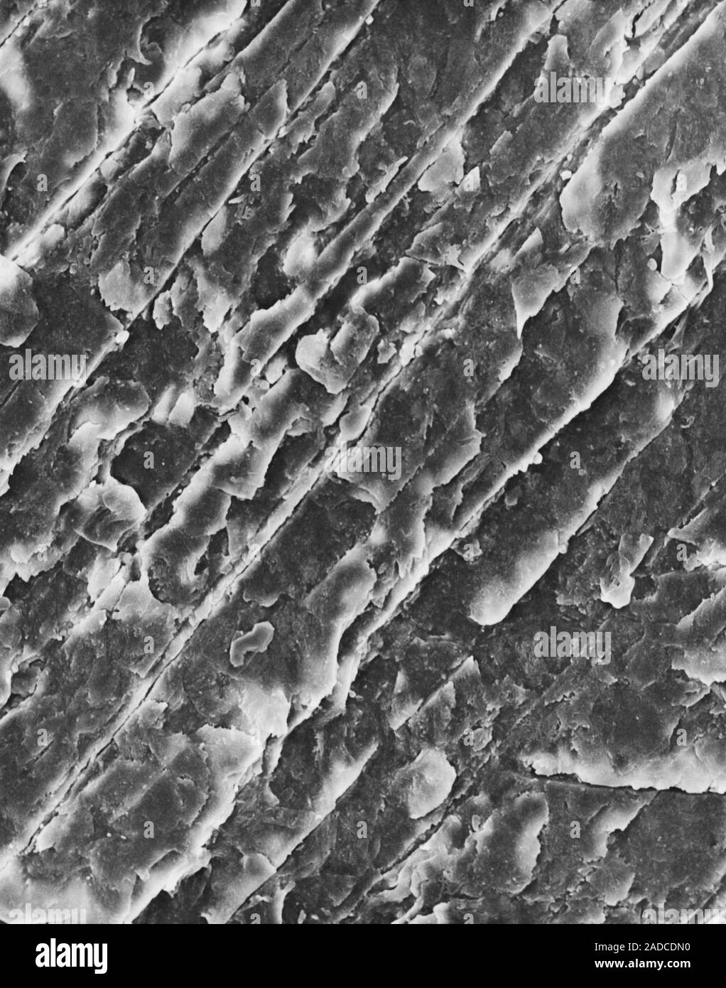 Human fingernail surface, scanning electron micrograph (SEM). The human ...