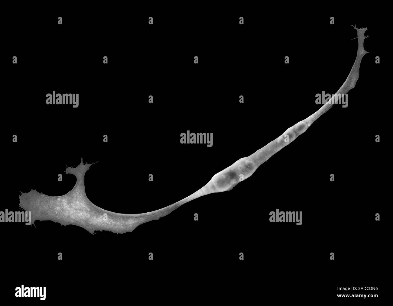 Human skeletal muscle from myoblast cell line (HSkM) in culture ...