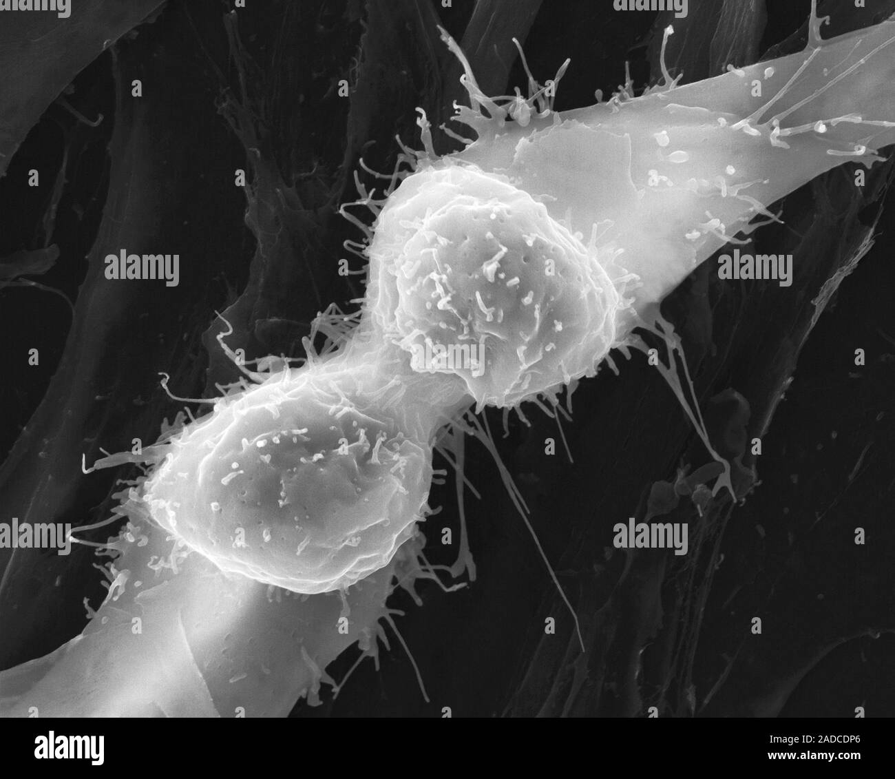 Muscle myoblast (primitive embryonic muscle cell) dividing, scanning ...