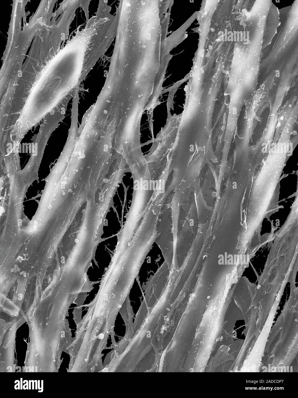 C2 skeletal muscle cells (myotubes) developing in culture, scanning ...