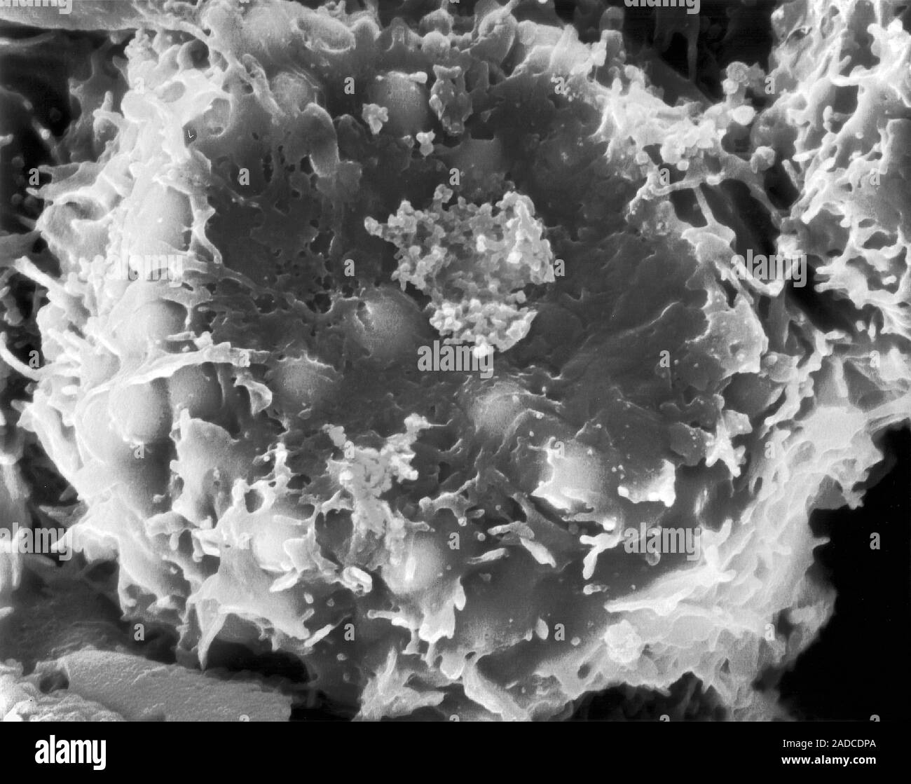 Human T lymphocyte with HTLV-1 infection, scanning electron micrograph ...