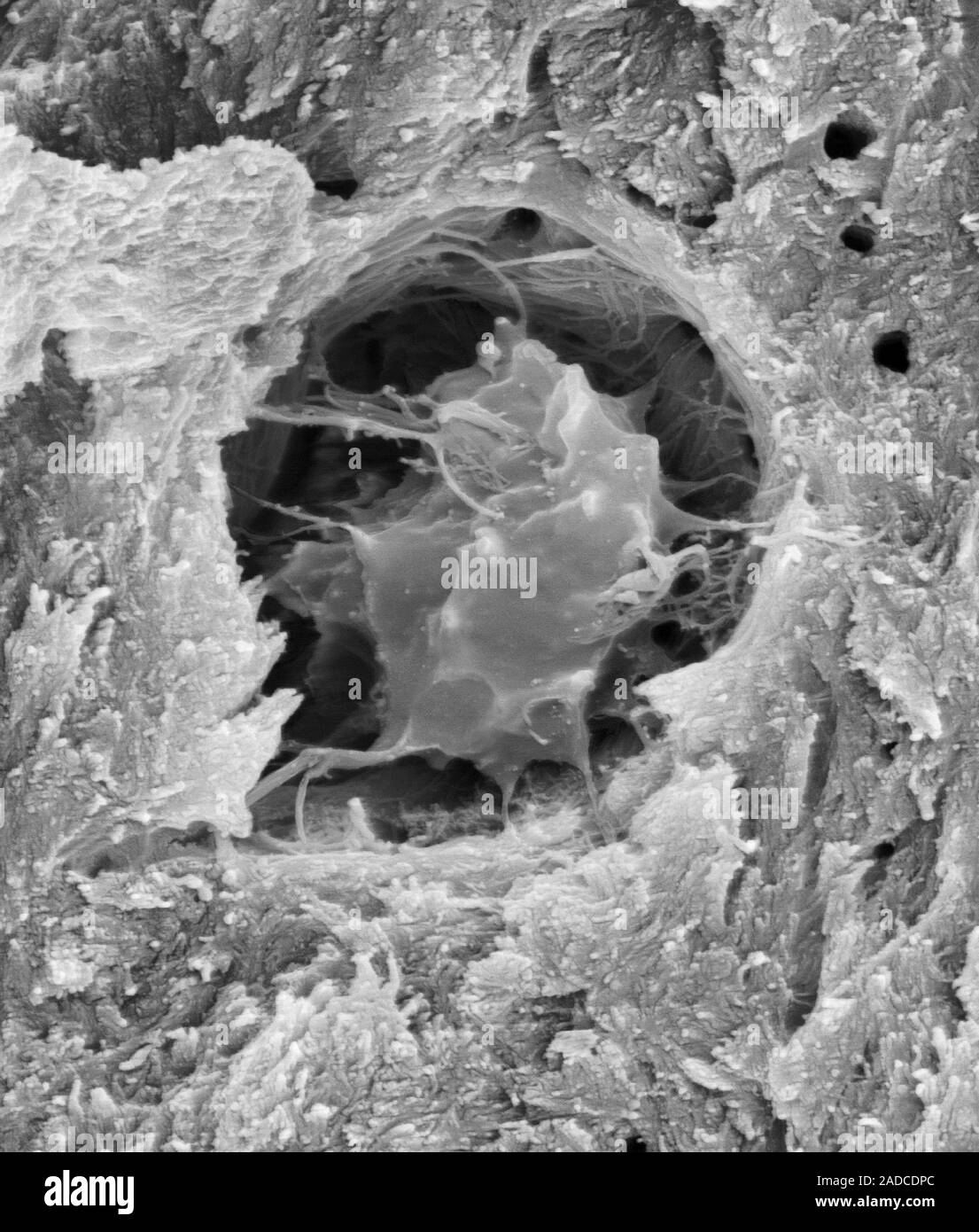 Fractured leg bone (mouse) with bone cells (osteocytes), scanning ...