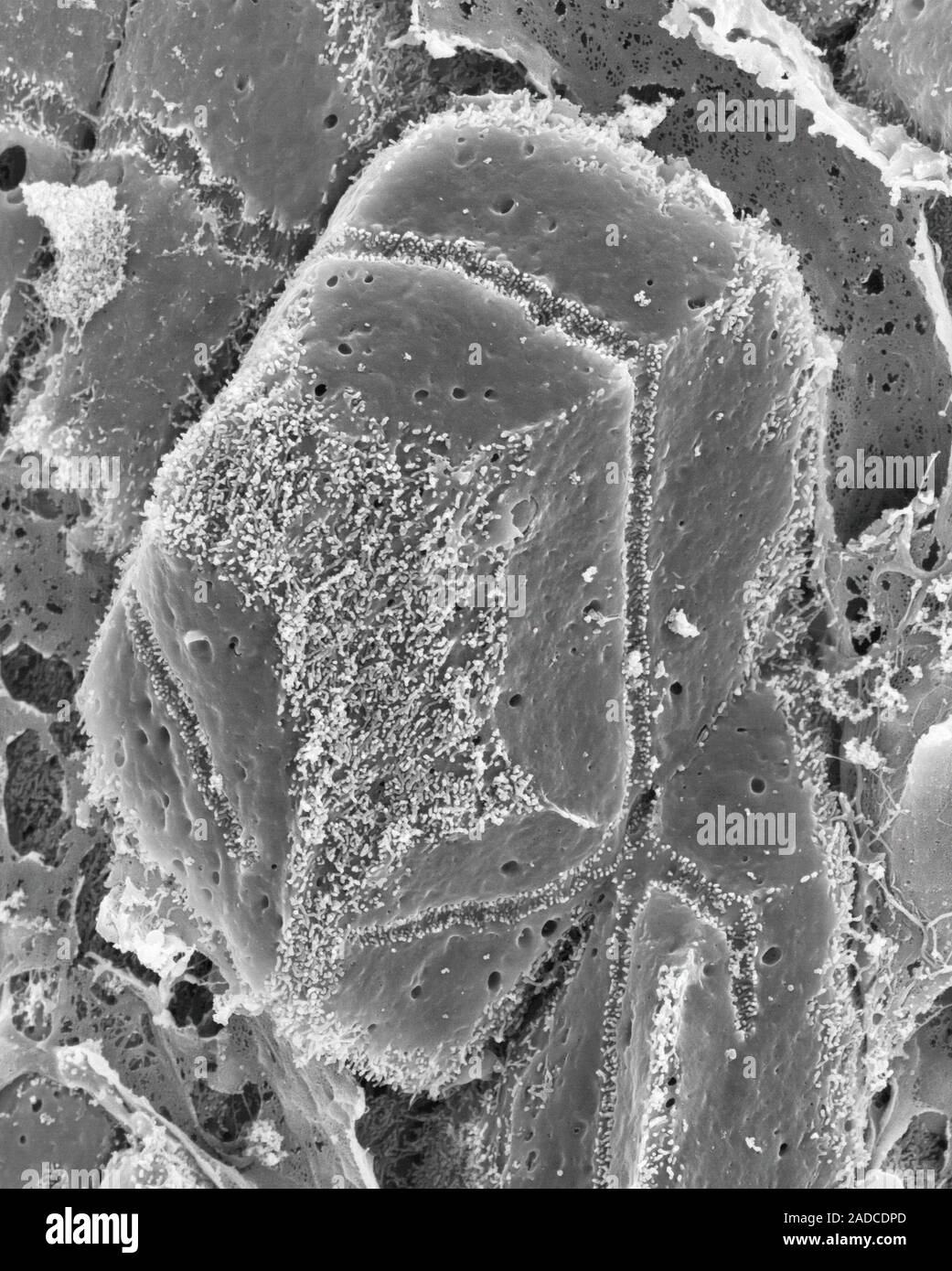 Liver polygonal hepatocytes and sinusoid area, scanning electron ...