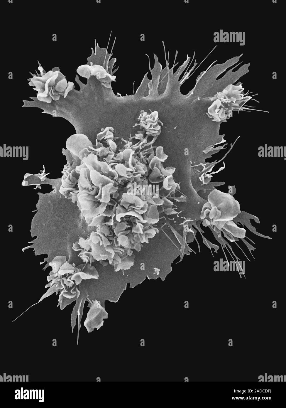 Human dendritic cell, scanning electron micrograph (SEM). Dendritic ...