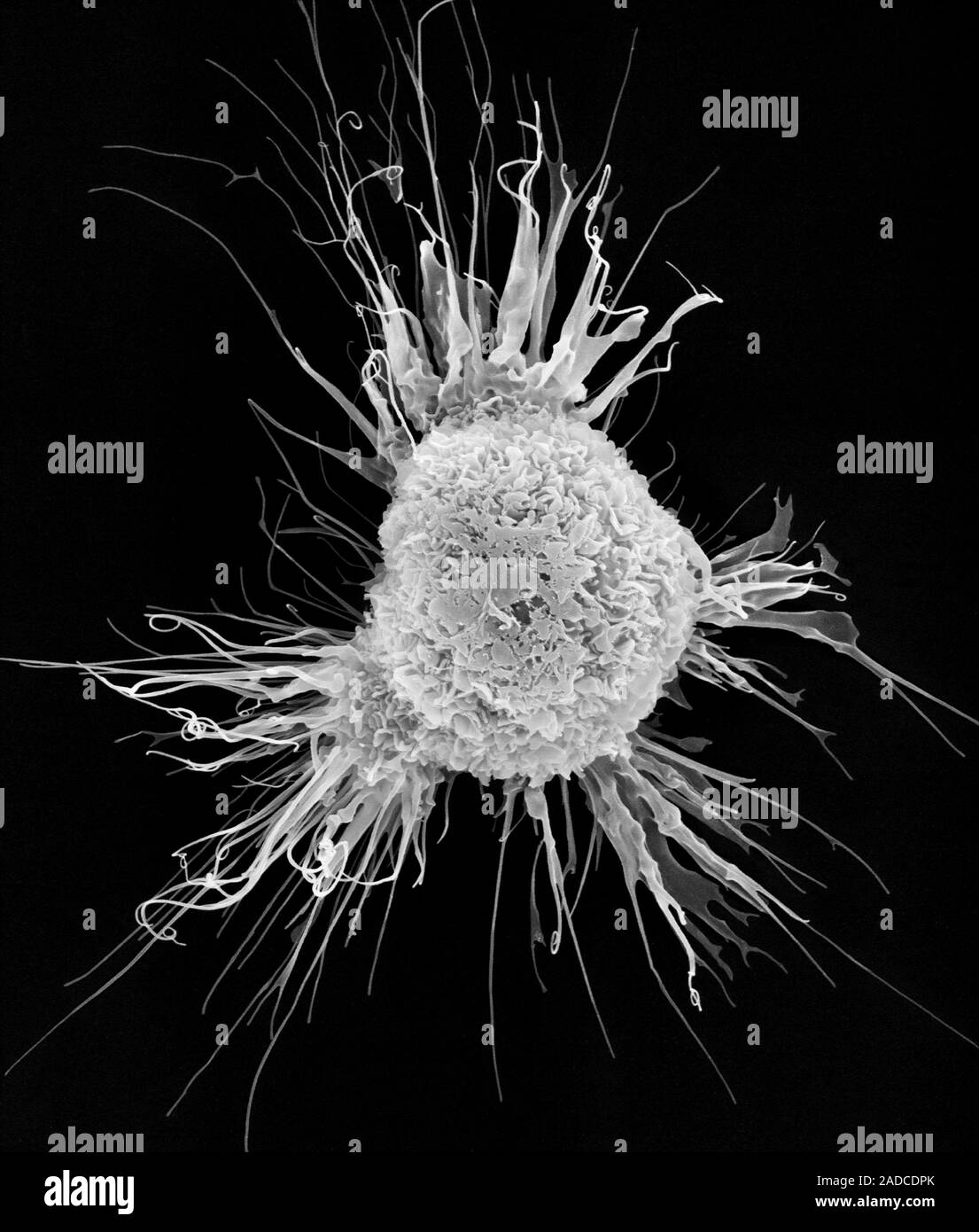 Mouse dendritic cell, scanning electron micrograph (SEM). Dendritic ...