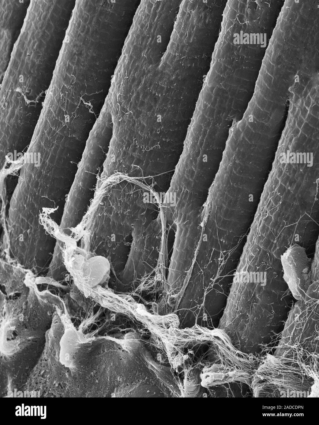 Contracted heart muscle fibres (ventricle) with partial overlying ...
