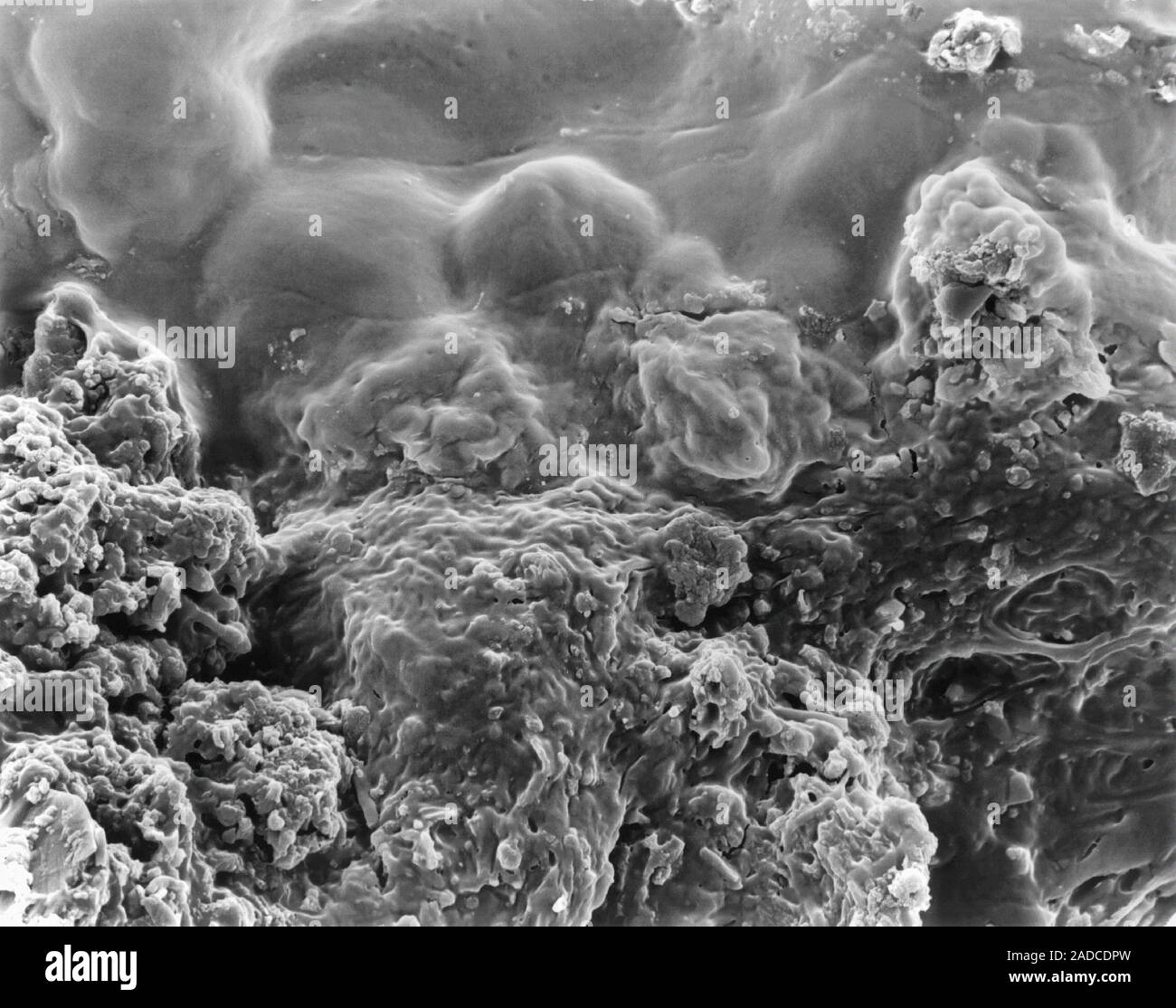 Human tooth with an accumulation of bacterial plaque (smooth areas) and ...