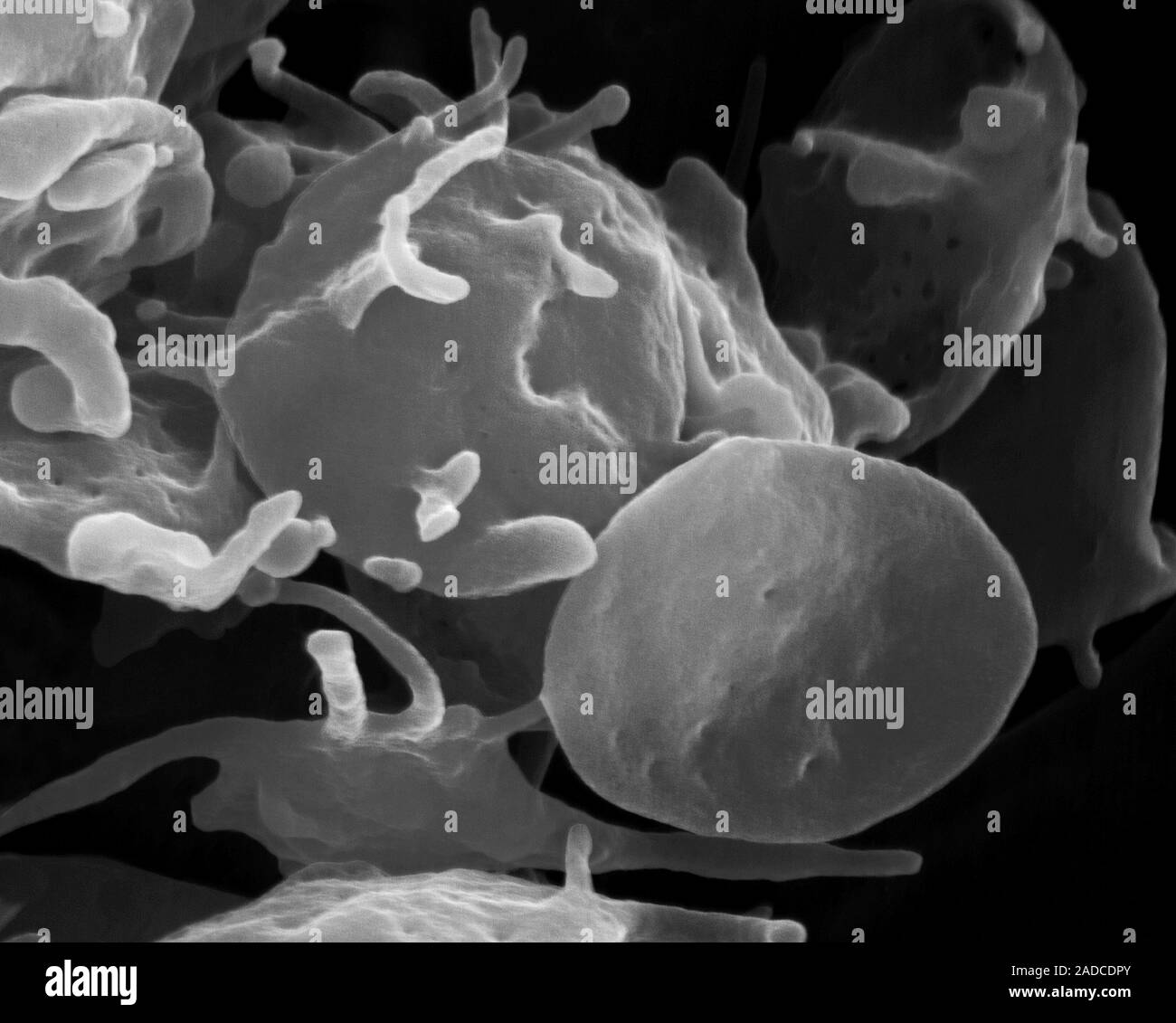 Activated and non-activated platelets with channels of the open ...