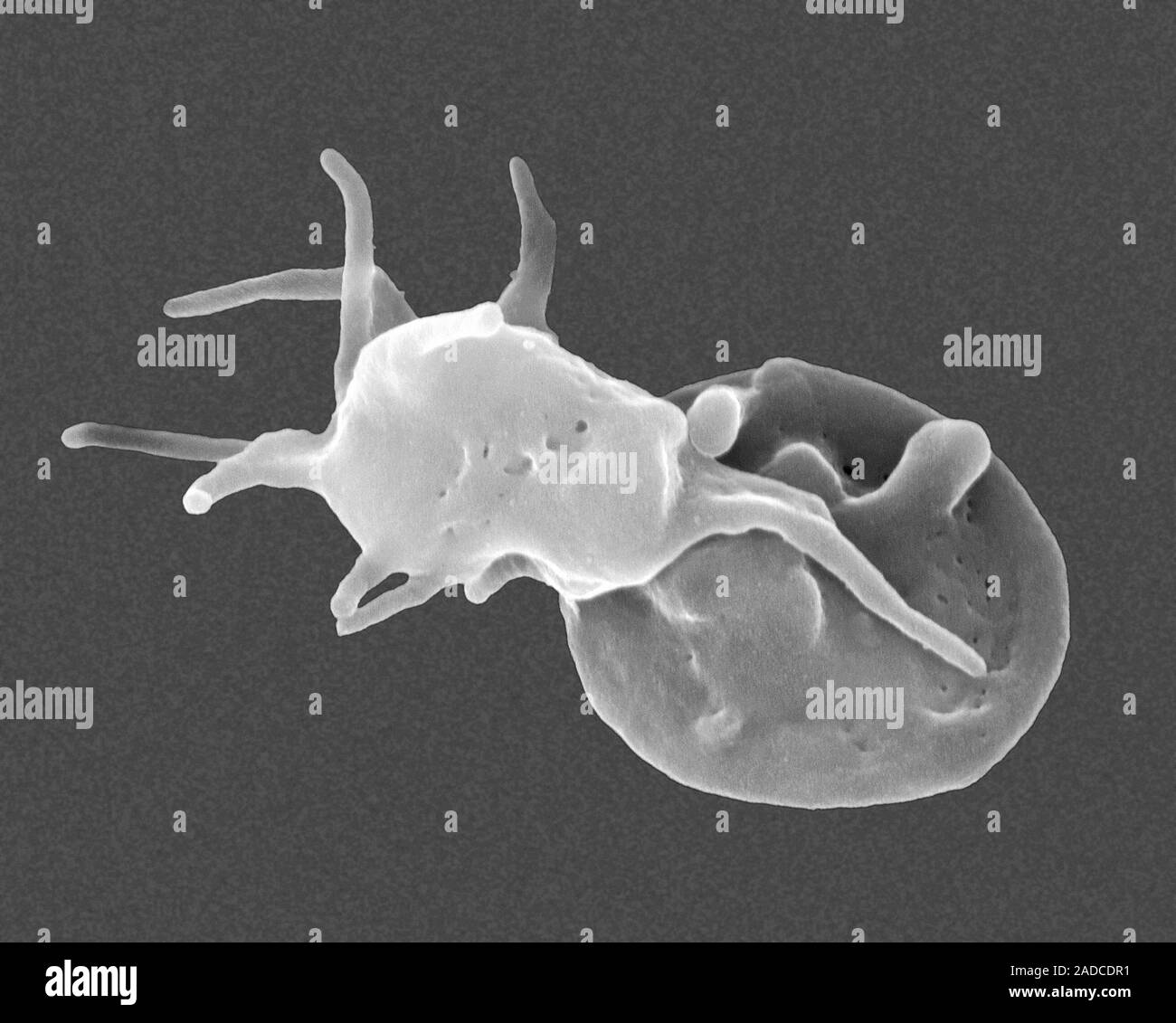 Activated and partially activated platelets with channels of the open ...