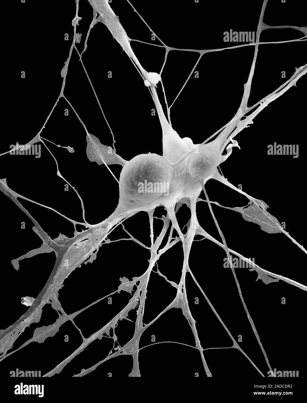 Pyramidal neurons from the central nervous system growing on a ...