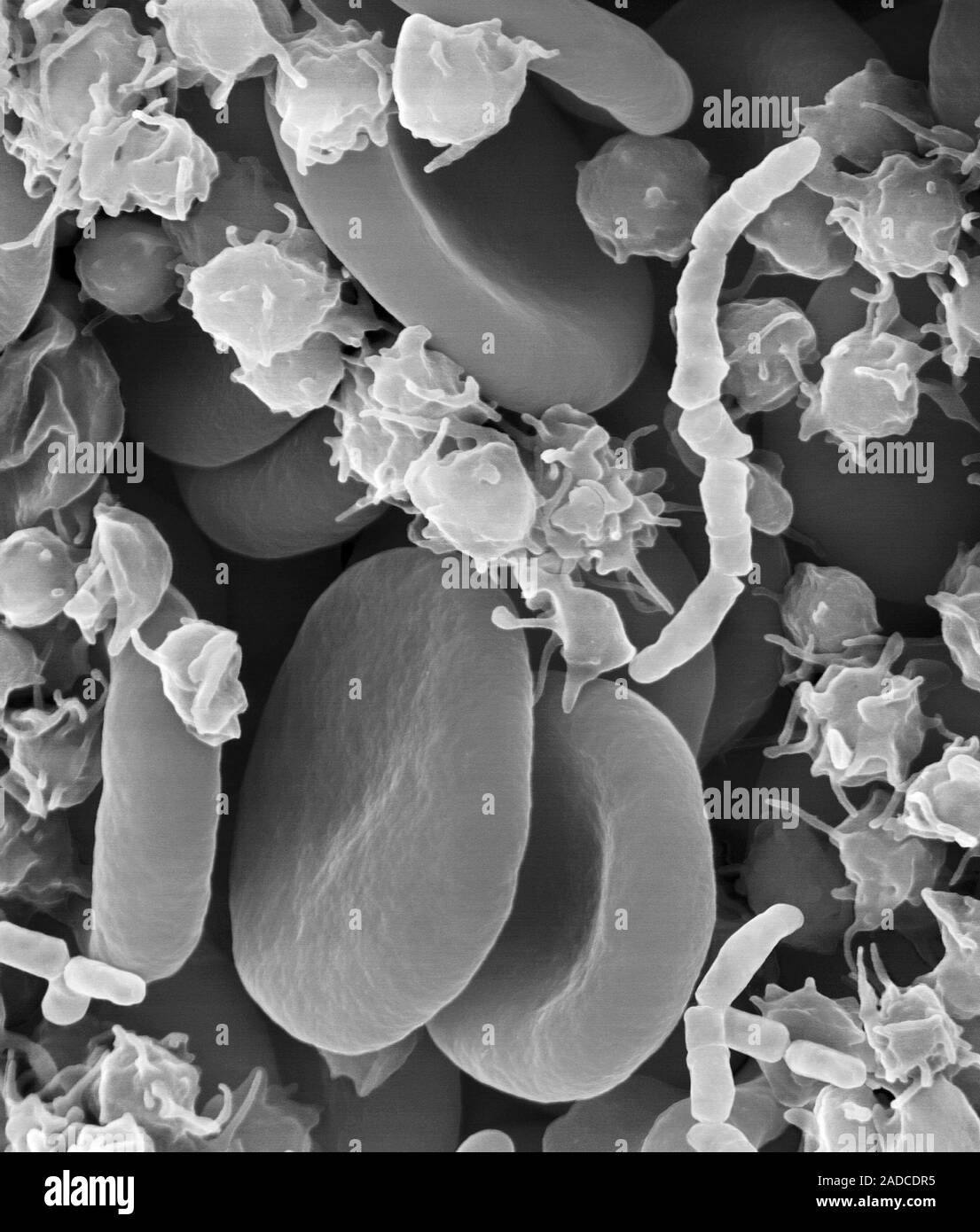 Bacterial blood infection caused by a rod shaped bacterium, scanning ...
