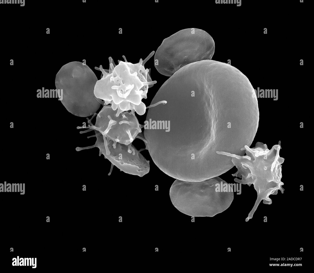 Activated (filopodial extensions) and non-activated (smooth, discoid ...