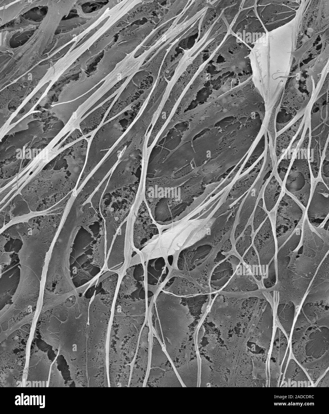 Human embryonic stem cells (HESCs) differentiating on a fibroblast ...