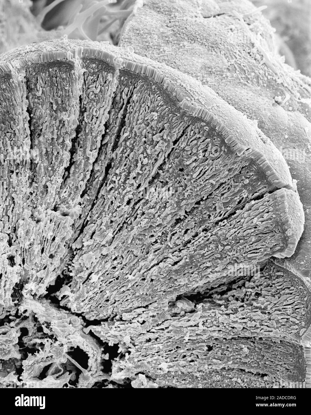 Small intestine villus, scanning electron micrograph (SEM). Columnar ...