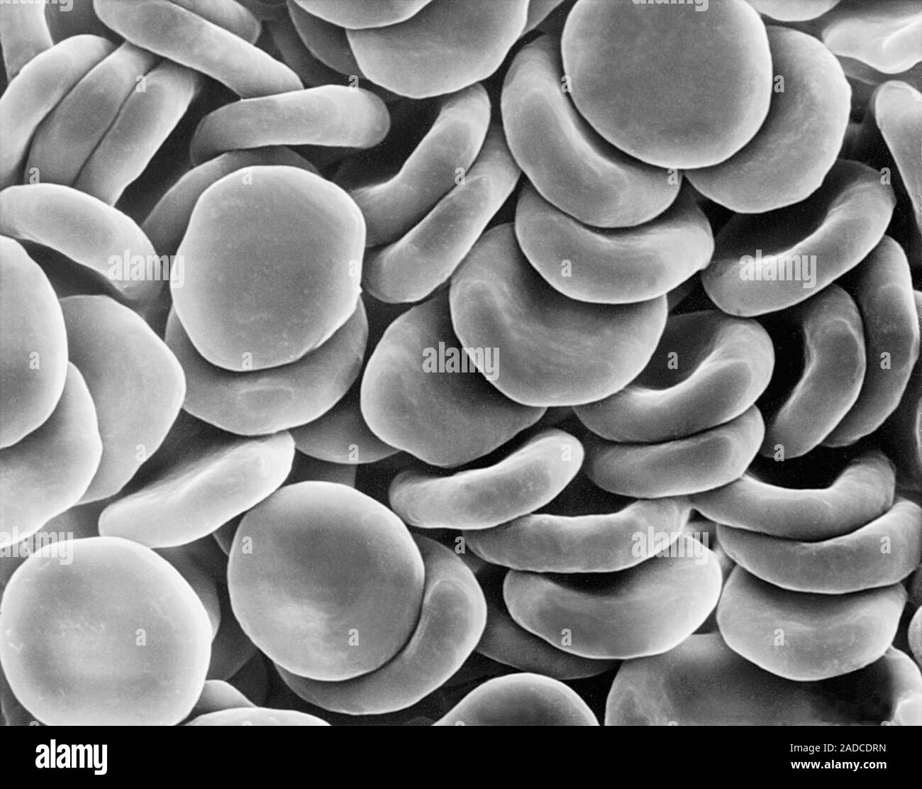 Human red blood cells (RBCs, isotonic), scanning electron micrograph ...