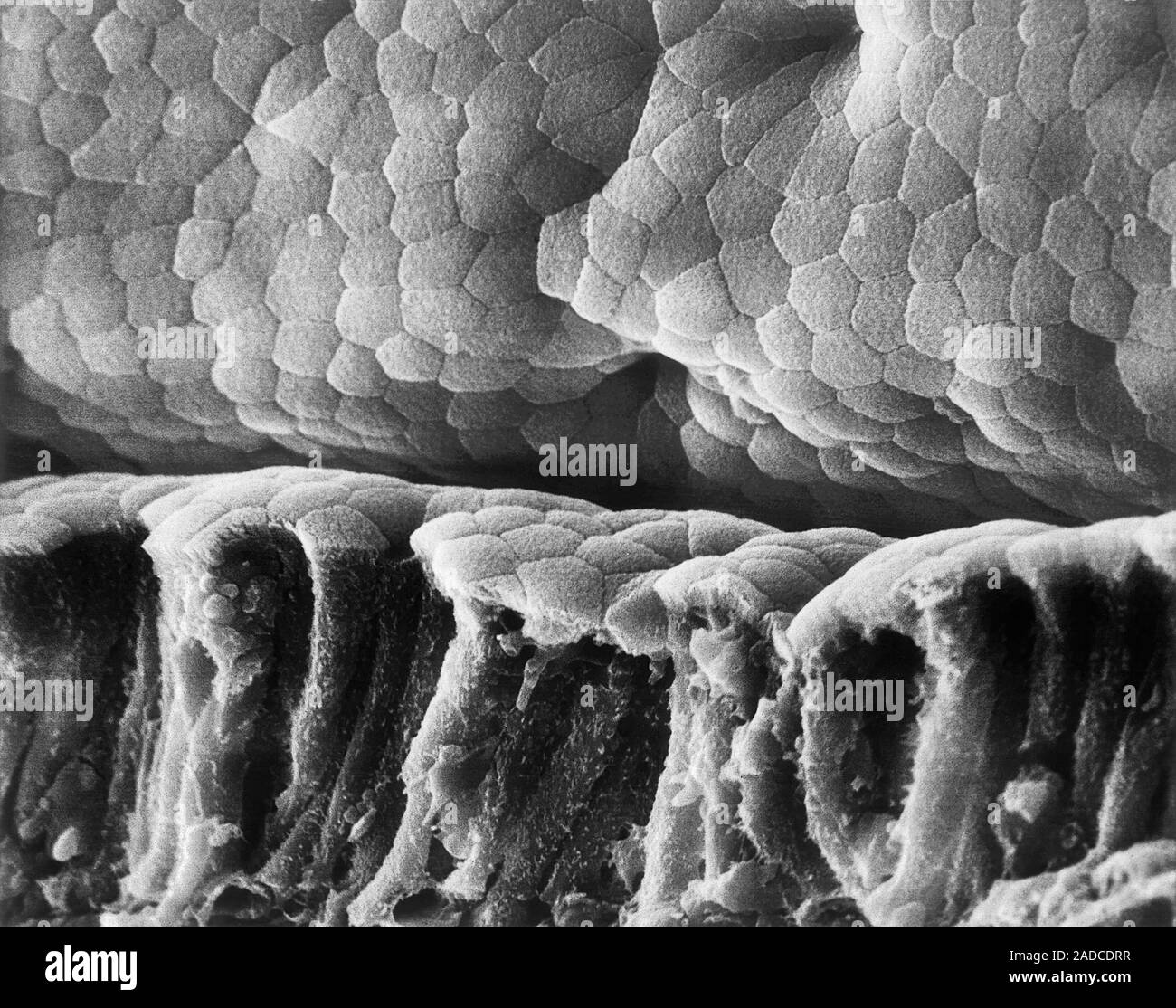 Villus surface of the small intestine; columnar epithelial cells ...